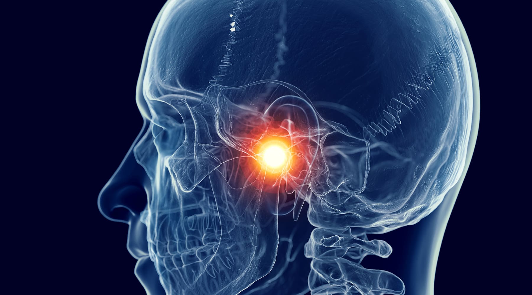 TMJ Disorder | Botox for TMJ | Concord Oral Surgery